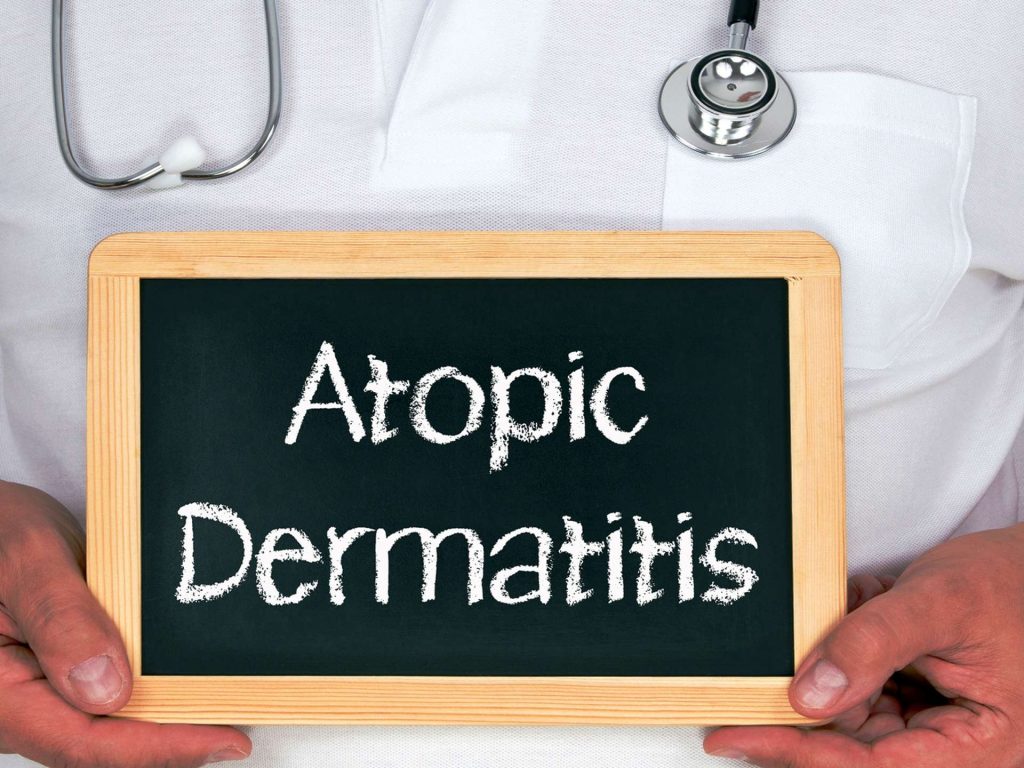 Atopic dermatitis - MOHO