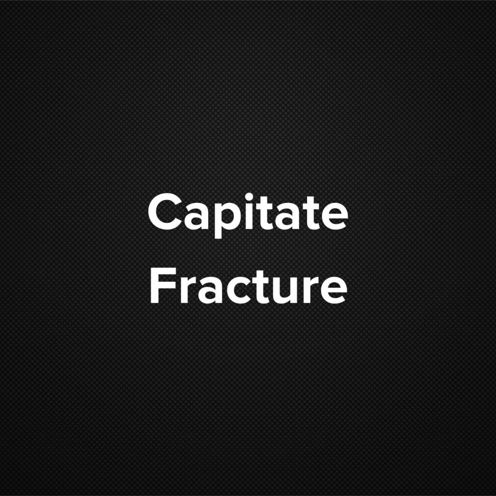 Capitate Fracture - MOHO