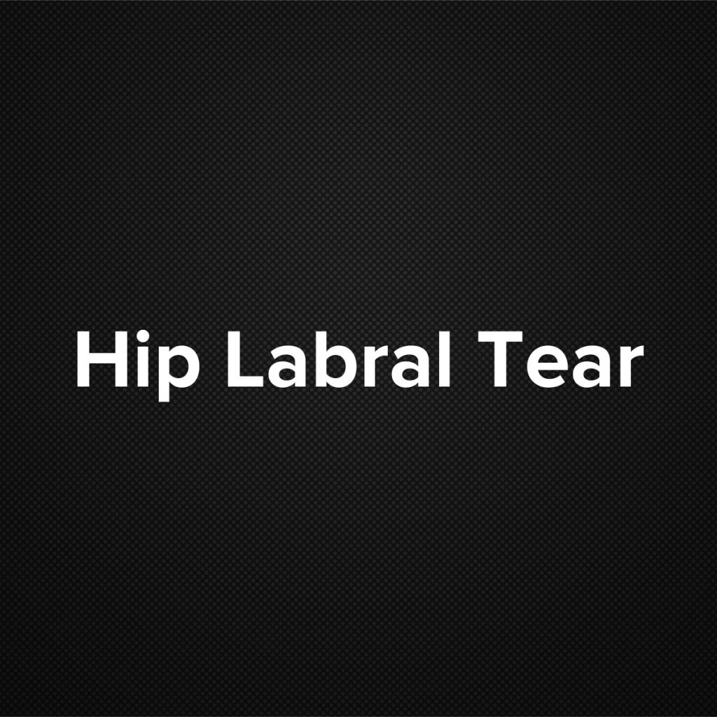 Hip Labral Tear - MOHO