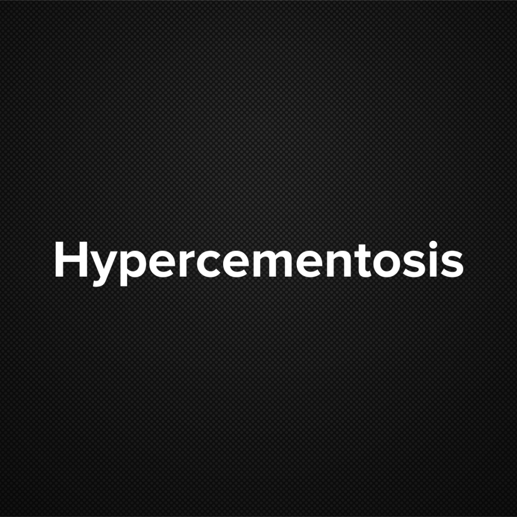 Hypercementosis - MOHO