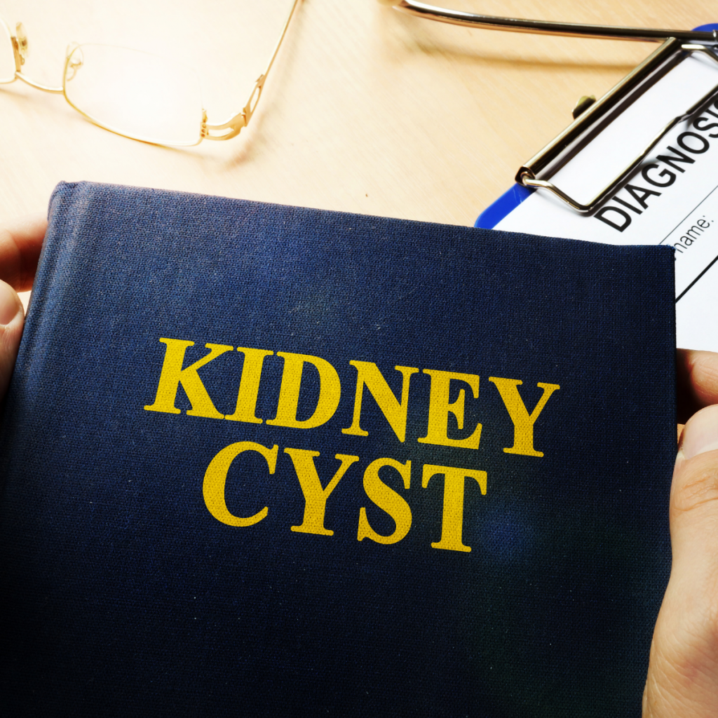 Kidney Cyst - MOHO